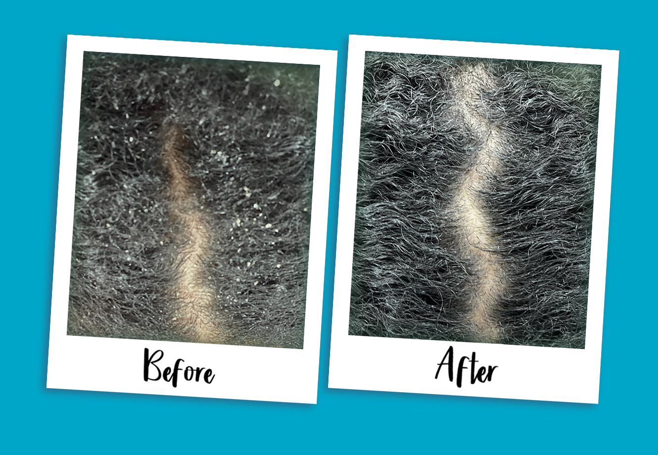 Hair Detox Kit | Curlsmith