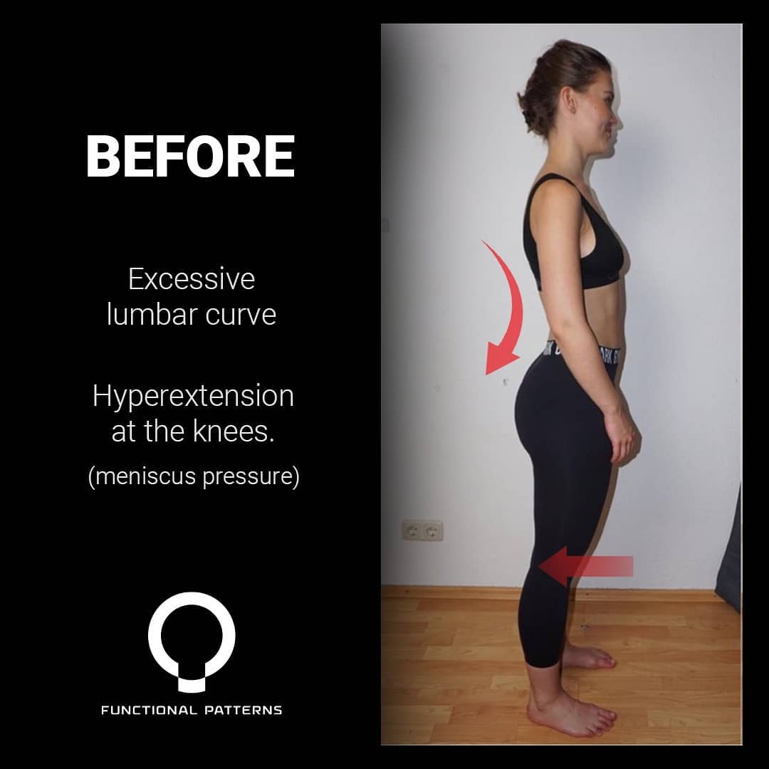 Is Functional Patterns Legit? | Results Speak for Themselves – Tagged ...