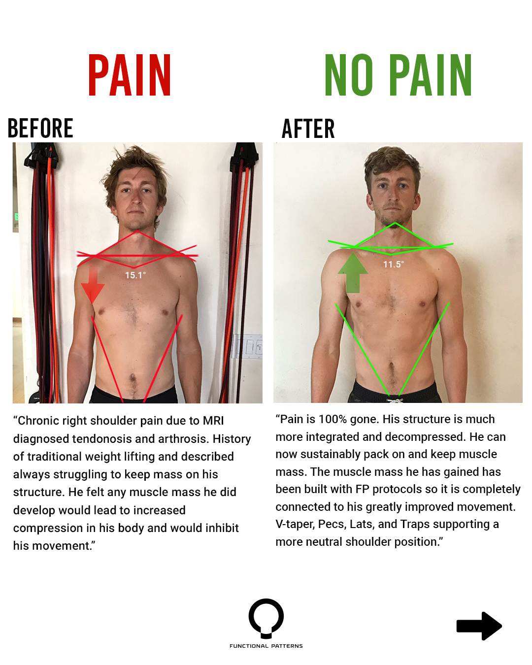 Is Functional Patterns Legit? | Results Speak for Themselves