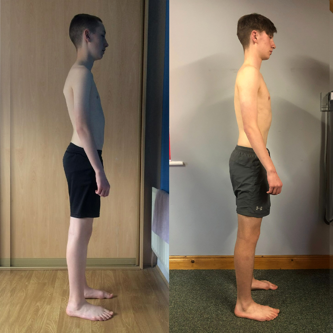 Is Functional Patterns Legit? | Results Speak for Themselves