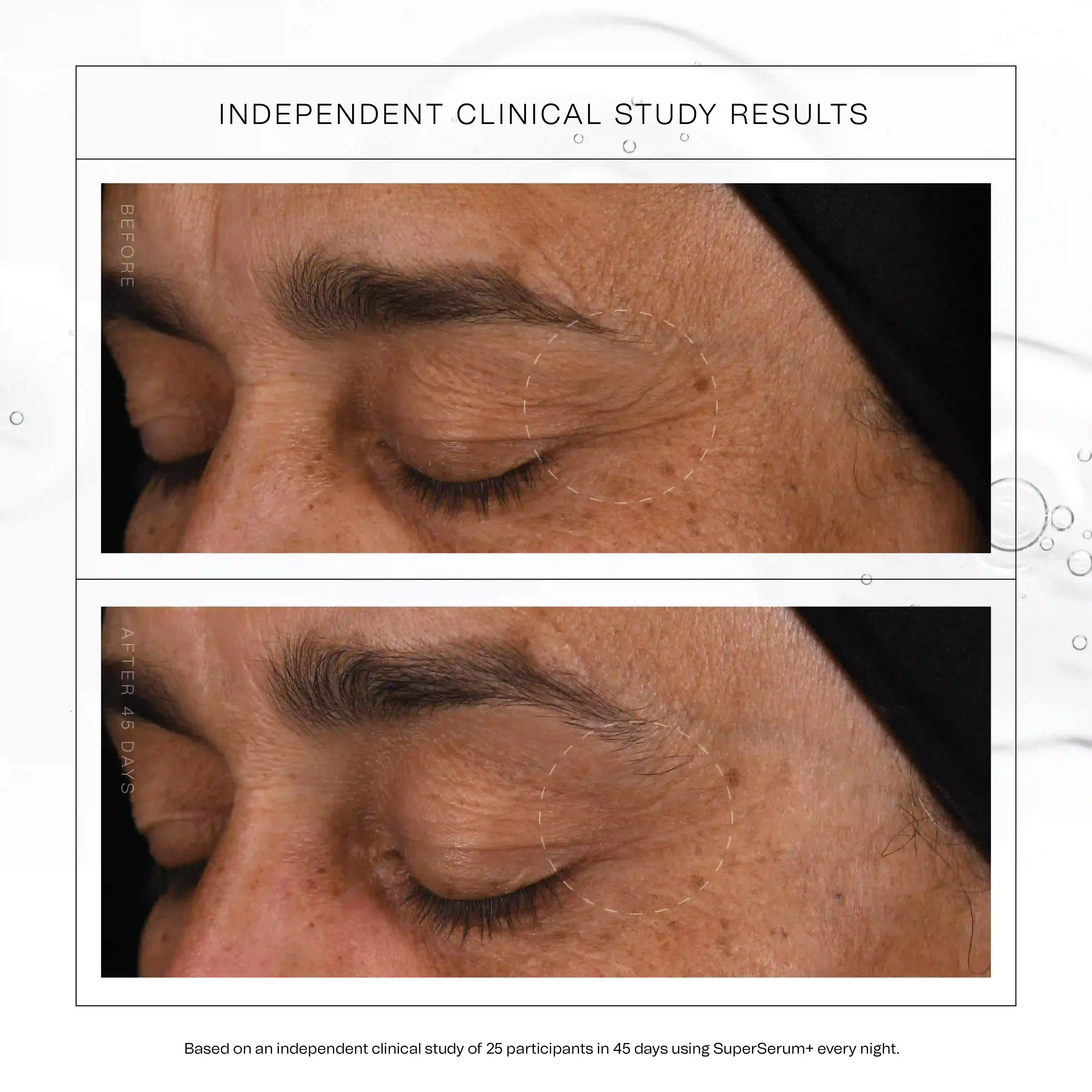 SuperSerum+ – Tried, Tested and Triumphant | Synergie Skin SuperSerum+ – Tried, Tested and Triumphant | Synergie Skin