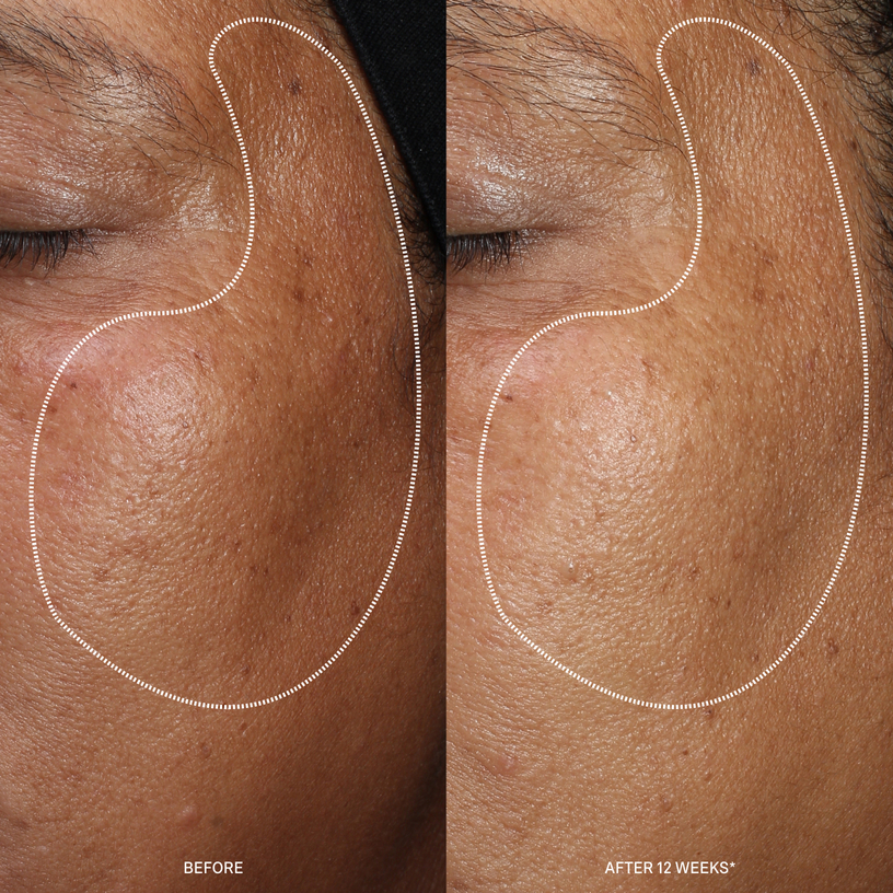 Molecular Hero Serum for Hyperpigmentation | Mother Science