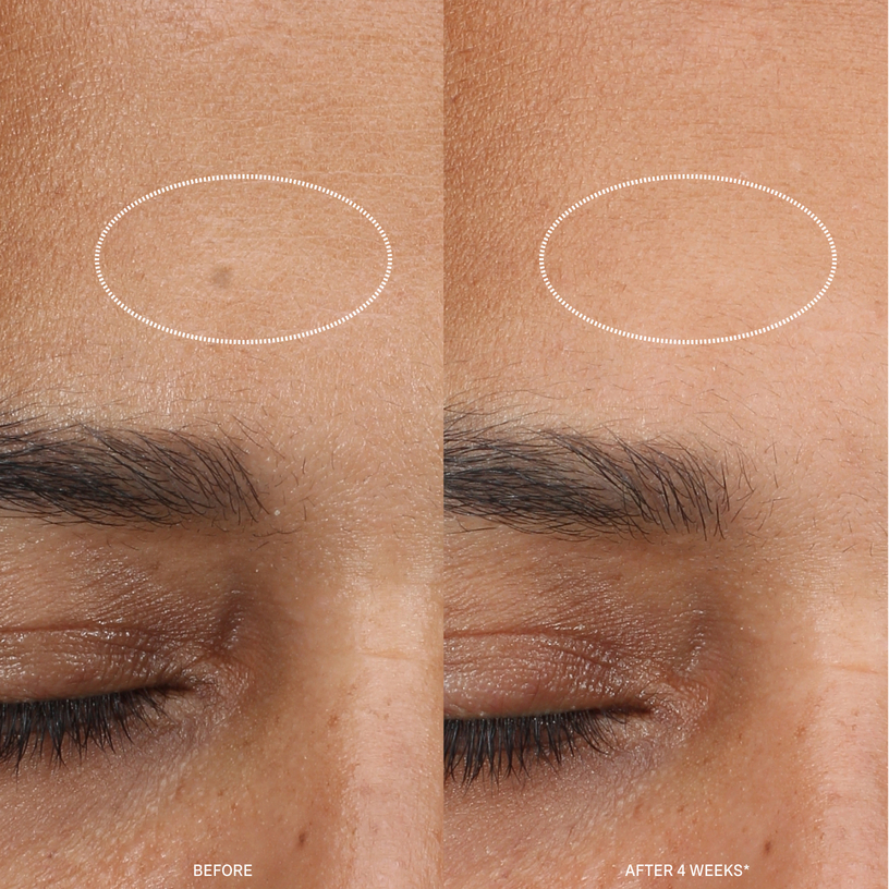 Molecular Hero Serum for Hyperpigmentation | Mother Science