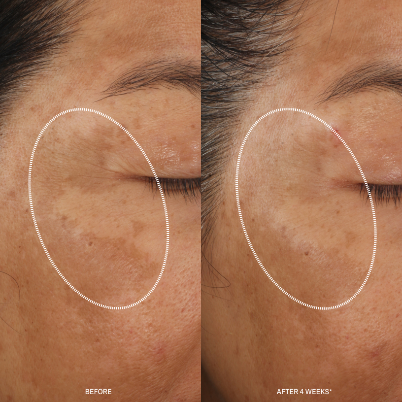 Molecular Hero Serum for Hyperpigmentation | Mother Science