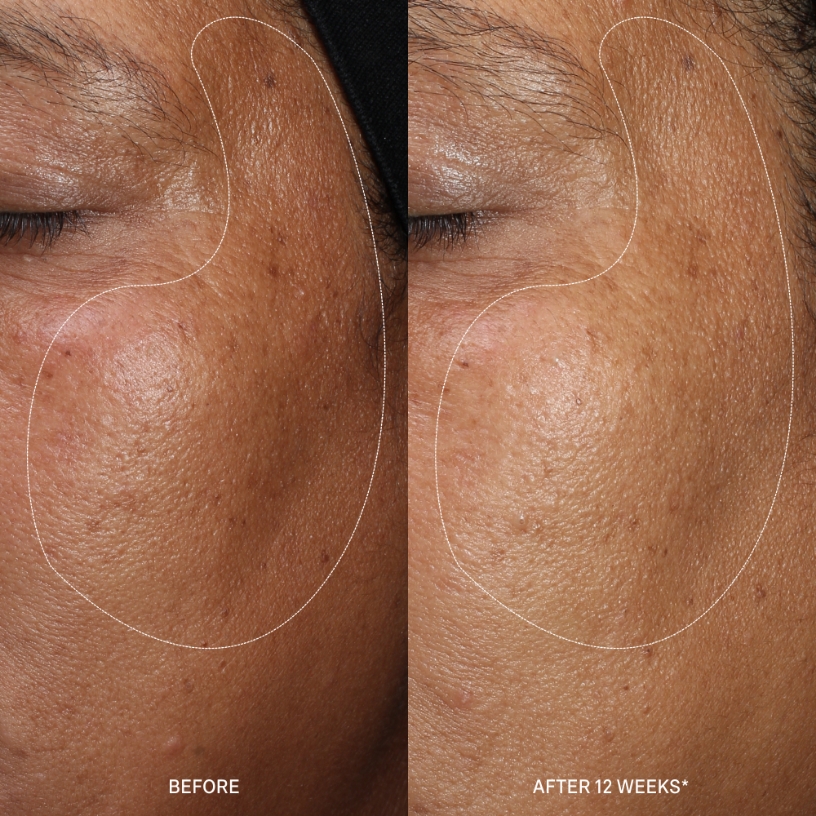 Molecular Hero Serum for Hyperpigmentation | Mother Science