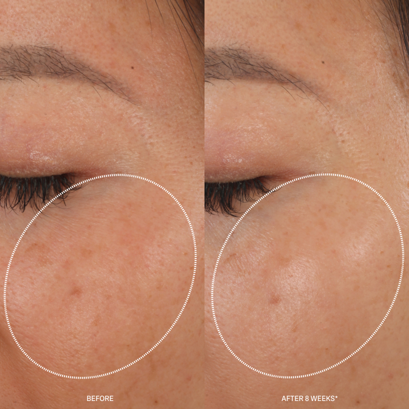 Molecular Hero Serum for Hyperpigmentation | Mother Science